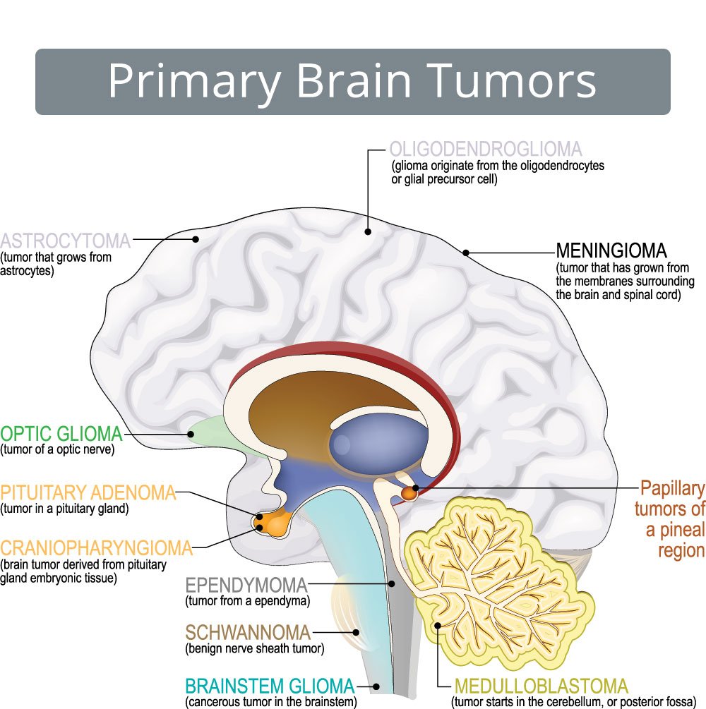 Support Gray: The Brain Tumor Symbol